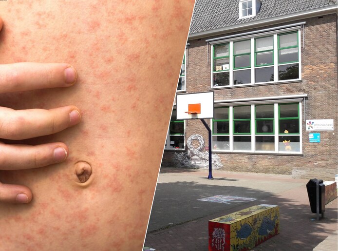 Geen mazelen op Vlissingse basisschool | Vlissingen | pzc.nl