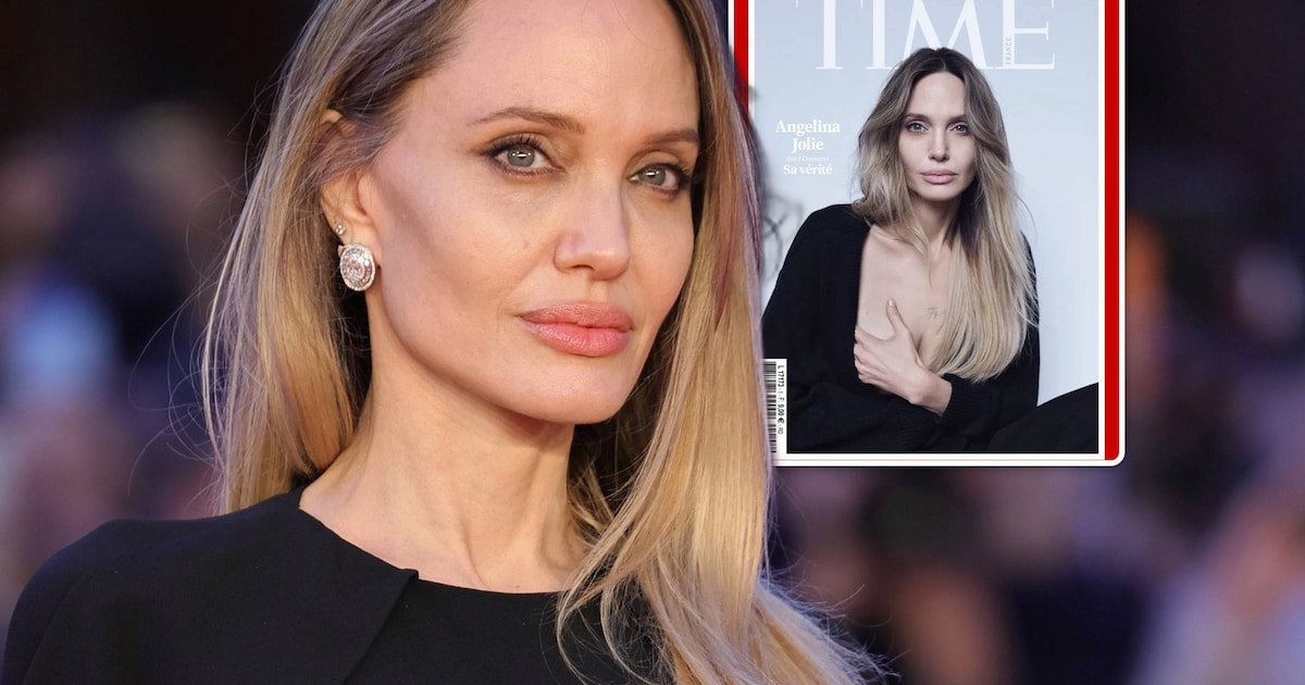 Angelina Jolie toont littekens van preventieve borstamputatie op ...